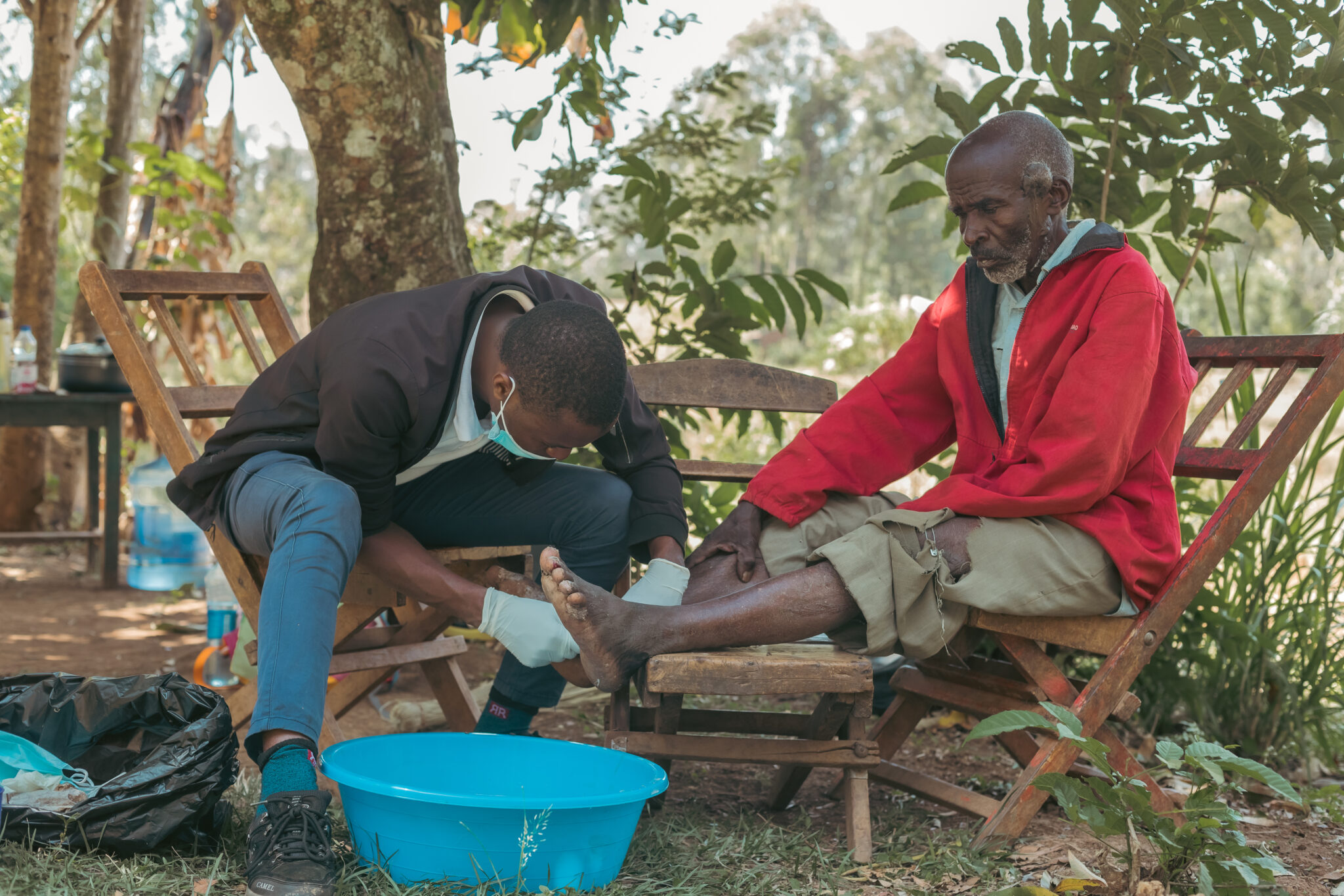 Jiggers: A Preventable Crisis with Life-Changing Consequences - The ...
